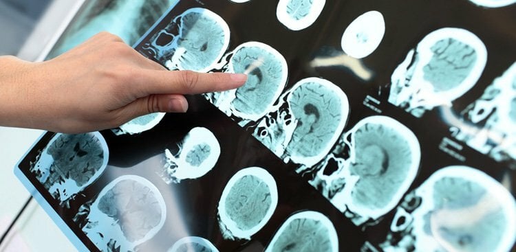 3 Key Signs You’re Too Smart for Your Job | The Muse | The Muse